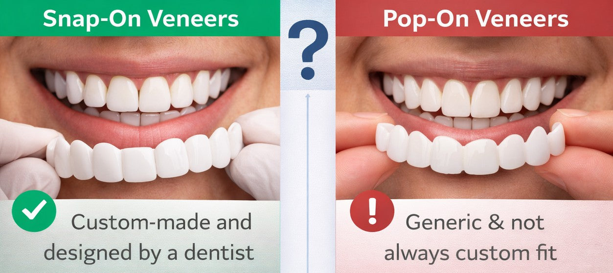 Are Snap-On Veneers and Pop-On Veneers the Same Thing? – Smile Boutique NY