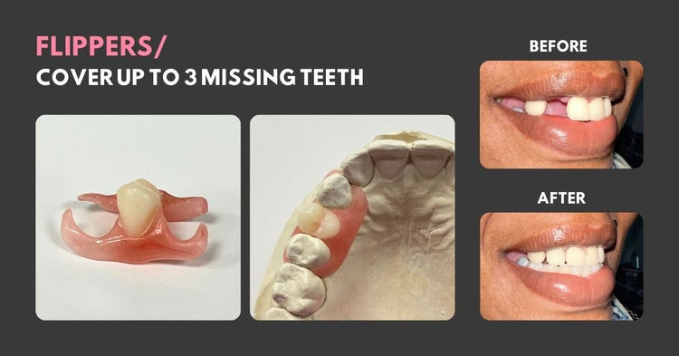 Flipper Tooth vs. Nesbit Partials: Cost, Types, Benefits, and Where to ...