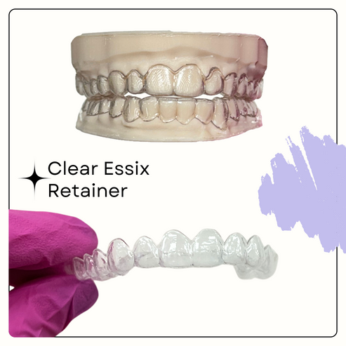 Affordable Essix Pontic Retainers: Top, Bottom, or Both – Now with ...