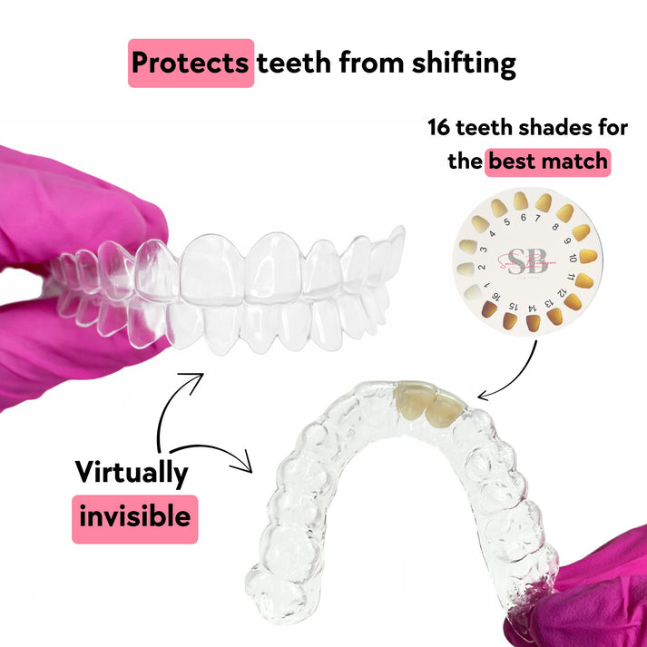 Affordable Essix Pontic Retainers: Top, Bottom, or Both – Now with ...