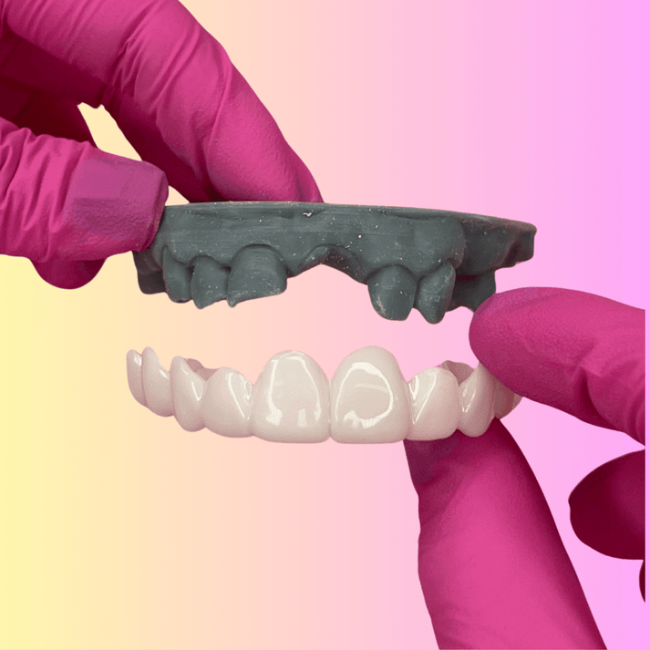 Top-Rated Snap-On Veneers Made in the USA | Affordable Removable ...
