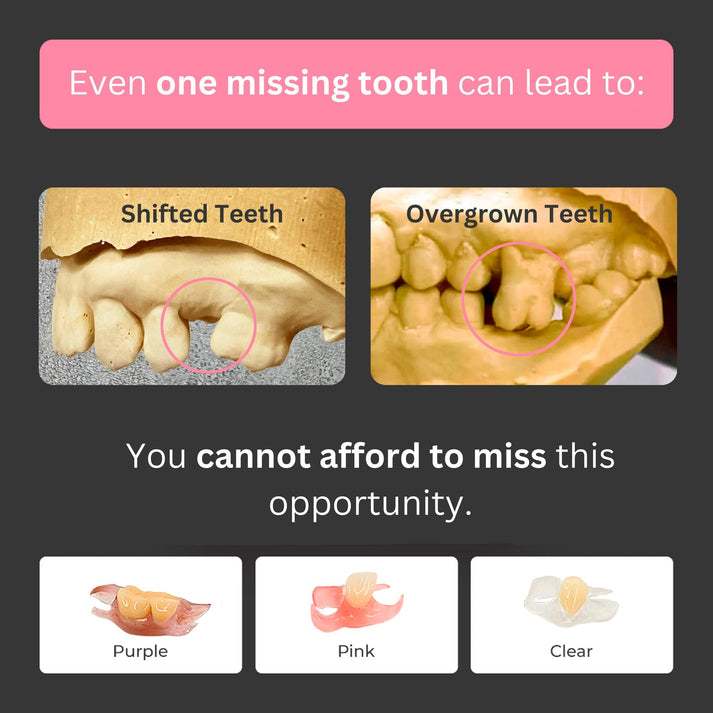 FLEXIBLE FLIPPER / DENTAL NESBIT COVERS UP TO 3 TEETH - $350 Sale