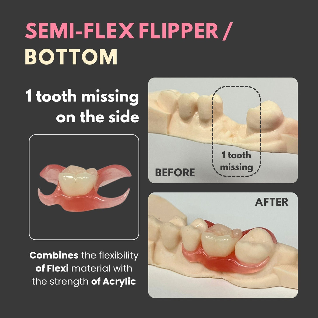 Semi-Flex Flipper for up to 3 Teeth Dental Solution – Smile Boutique NY
