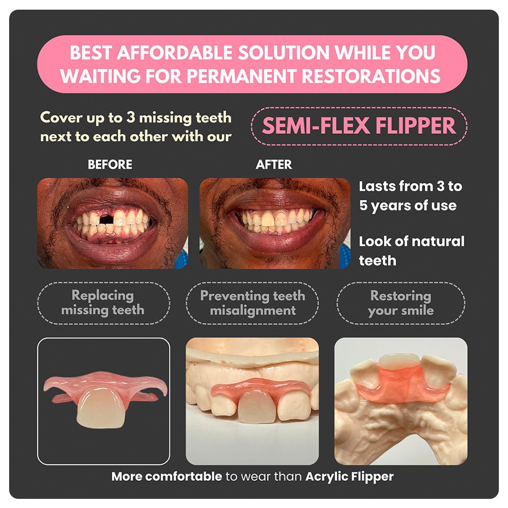 Semi-Flex Flipper for up to 3 Teeth Dental Solution